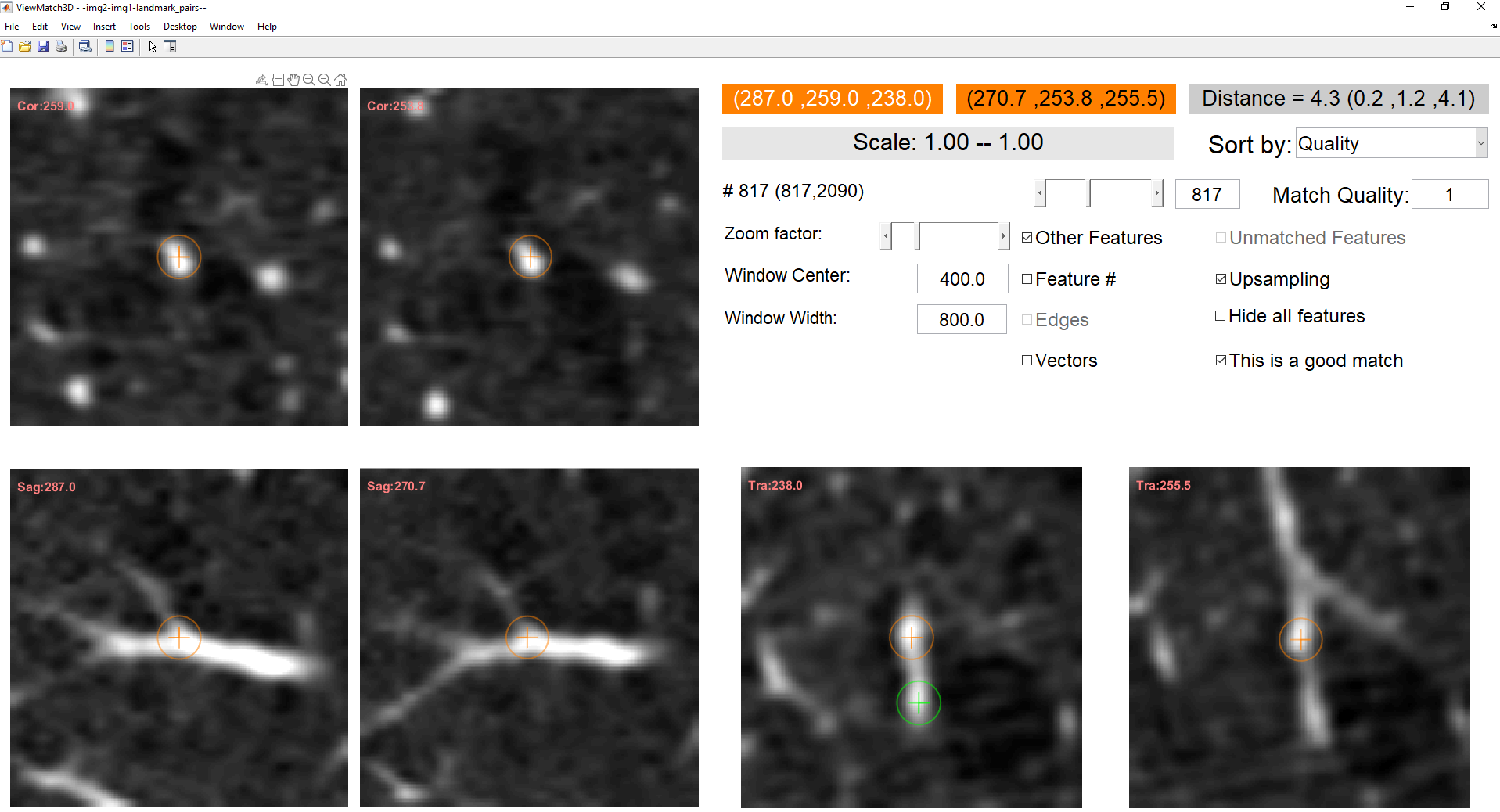 GitHub - deshanyang/Lung-DIR-QA: Dataset of CT image pairs with ...