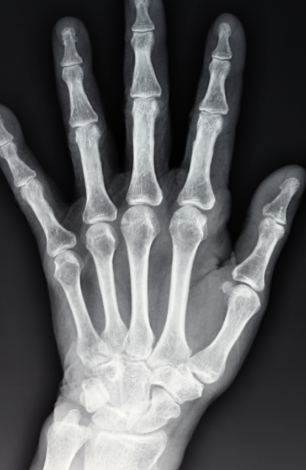 X-Ray rendering · Issue #3672 · isl-org/Open3D · GitHub