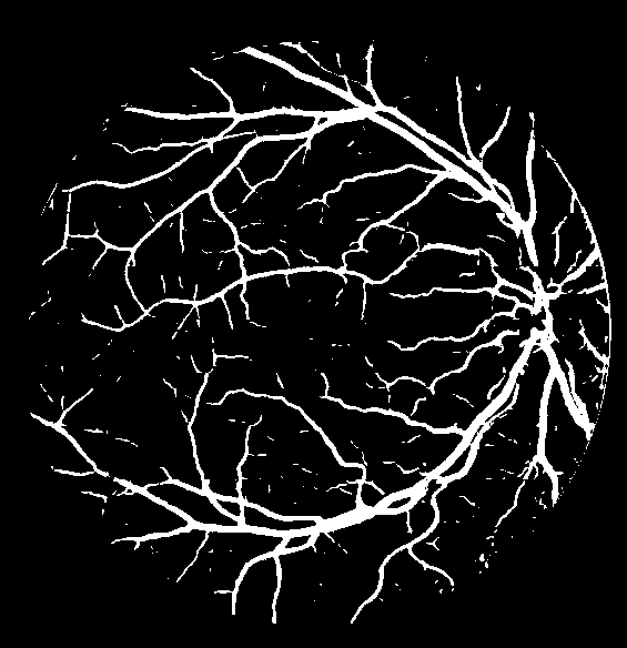 GitHub - krishnabairavi95/retina-segmentation-CNN-