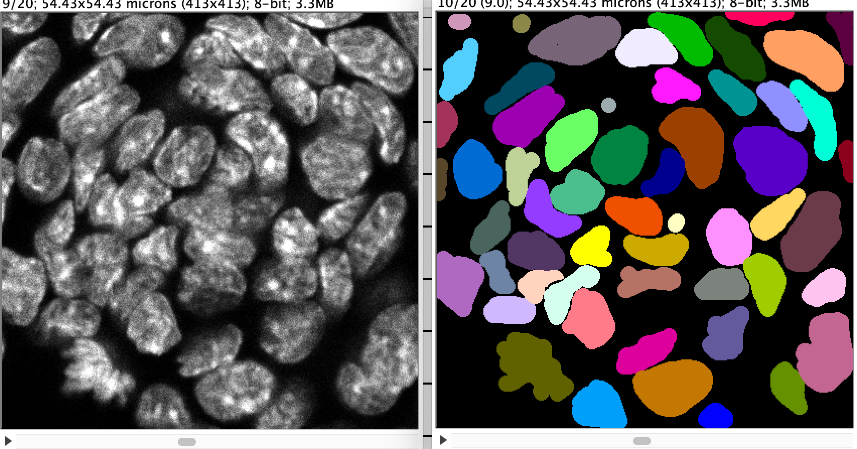 Loading Stardist3d Models After Training · Issue 35 · Stardist Stardist · Github