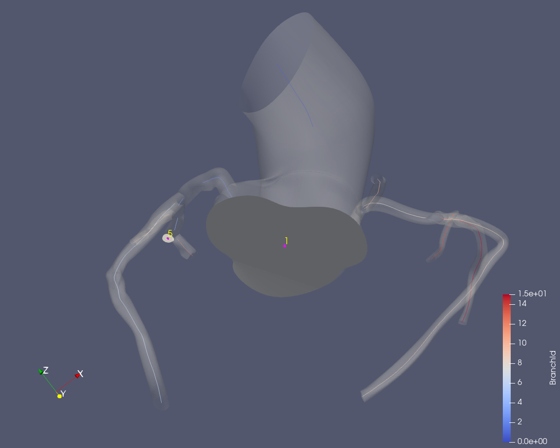 Order of outlets wrong in 1D model · Issue #848 · SimVascular/SimVascular · GitHub