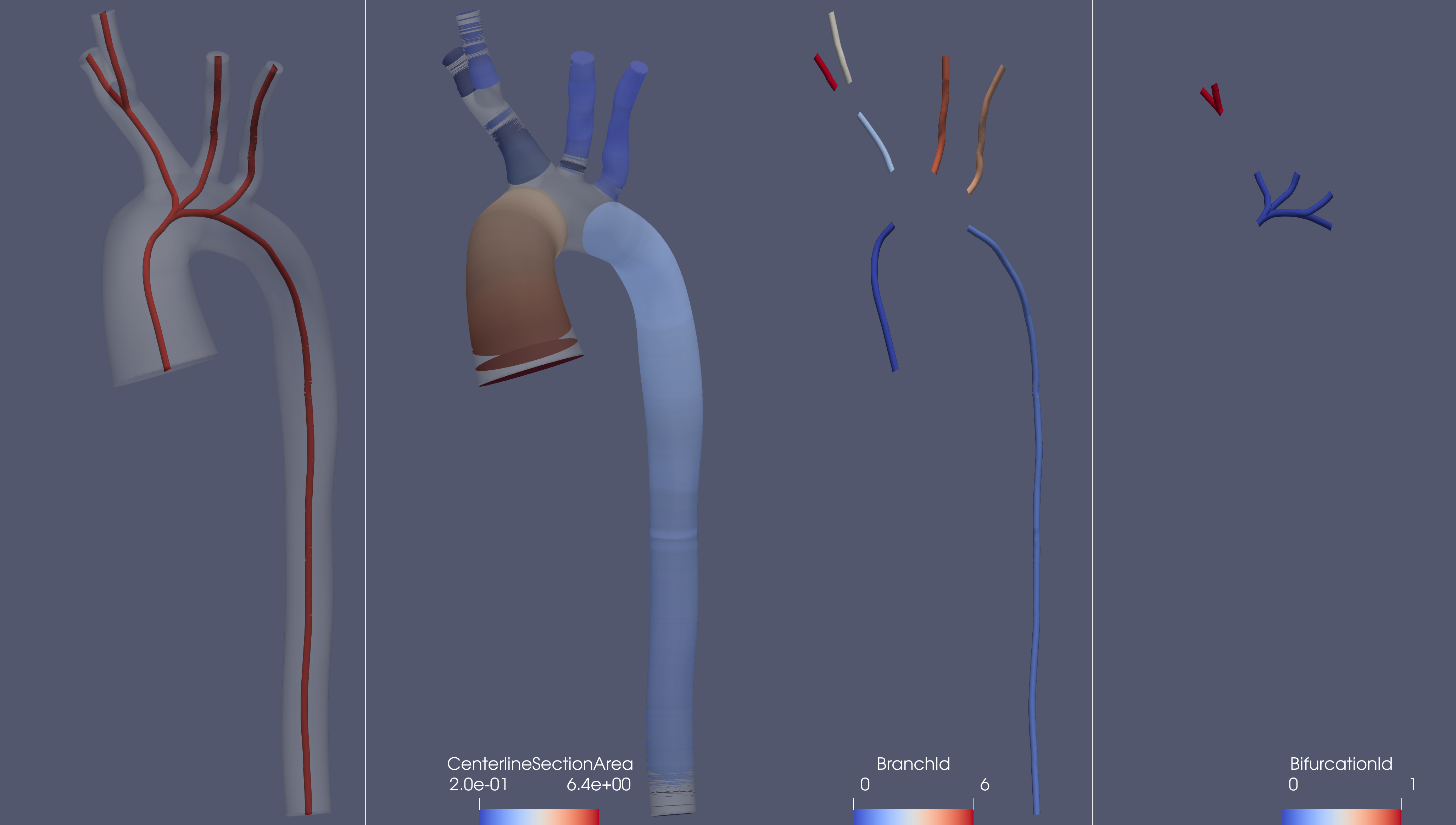 New centerline generation and 3D-1D pipeline · Issue #655 · SimVascular/SimVascular · GitHub