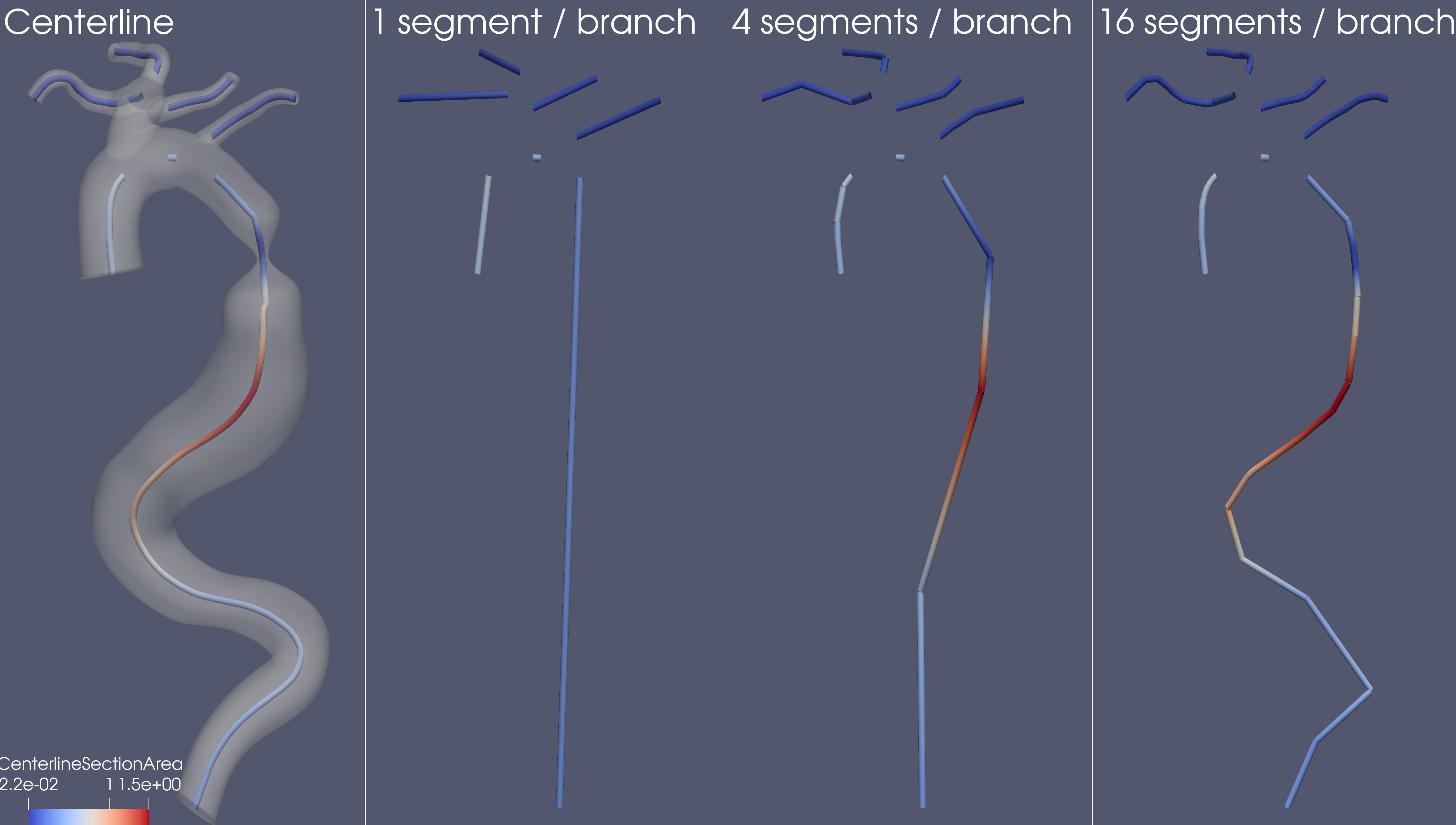New centerline generation and 3D-1D pipeline · Issue #655 · SimVascular/SimVascular · GitHub