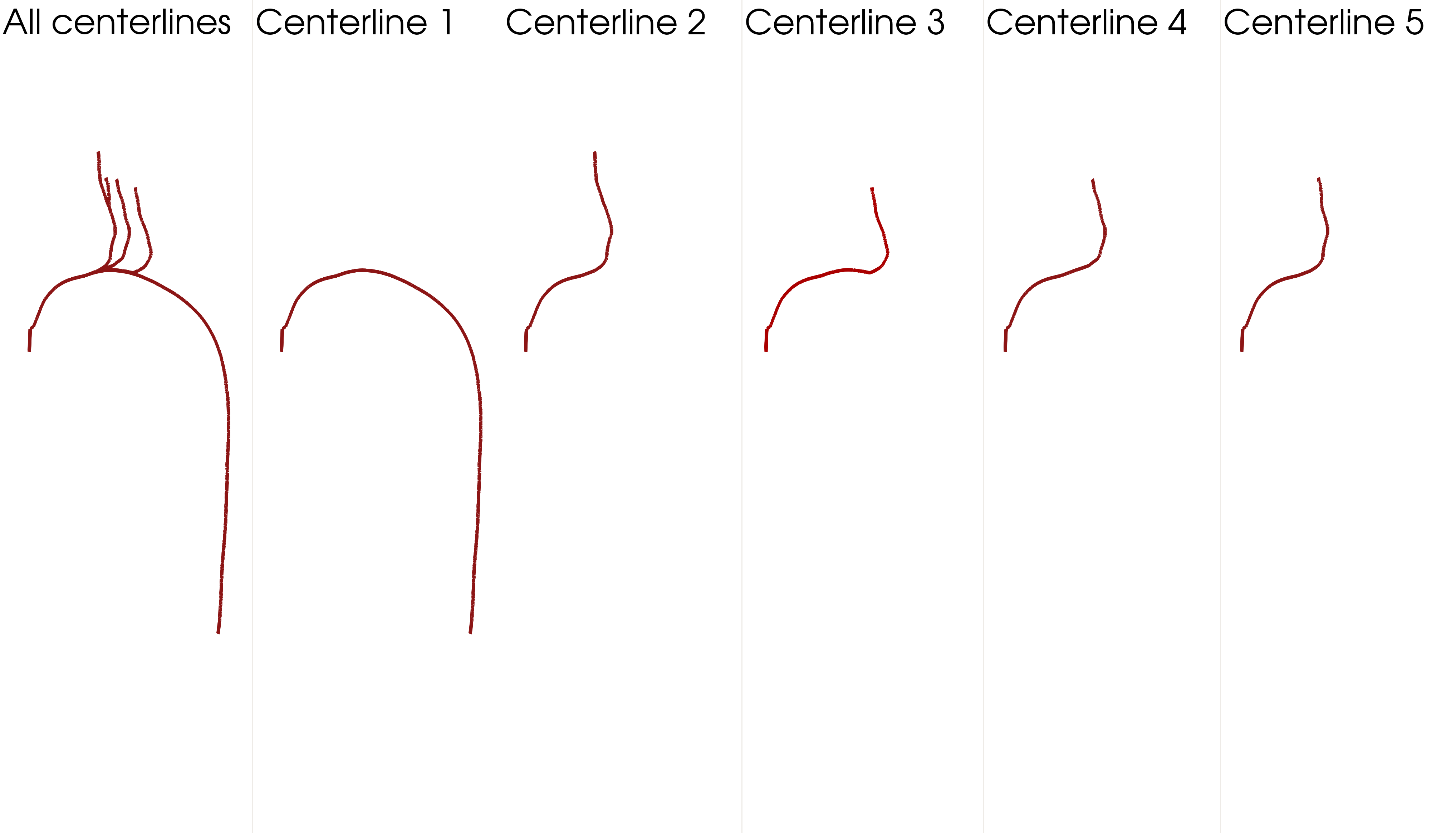 New centerline generation and 3D-1D pipeline · Issue #655 · SimVascular/SimVascular · GitHub