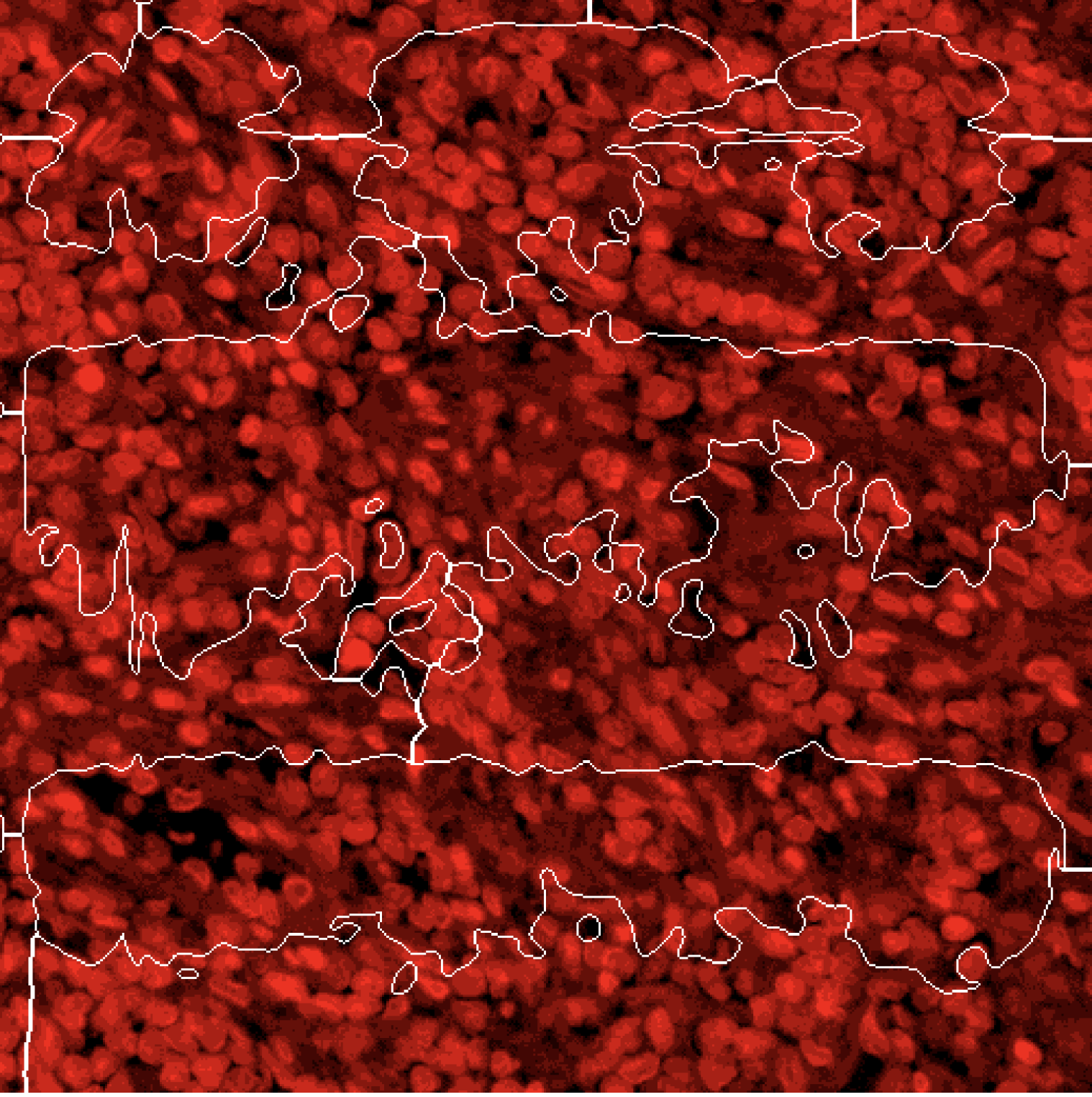 Weird Segmentation Results · Issue 139 · Dana Farber Aios Pathml · Github