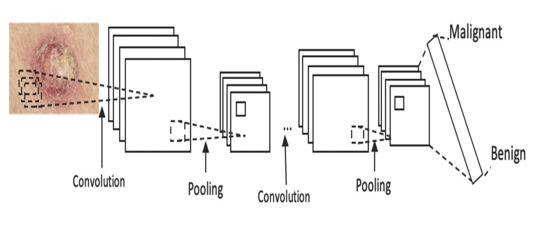 GitHub - hrx000/Benign-or-Malignant-Tumor-detection-By-CNN