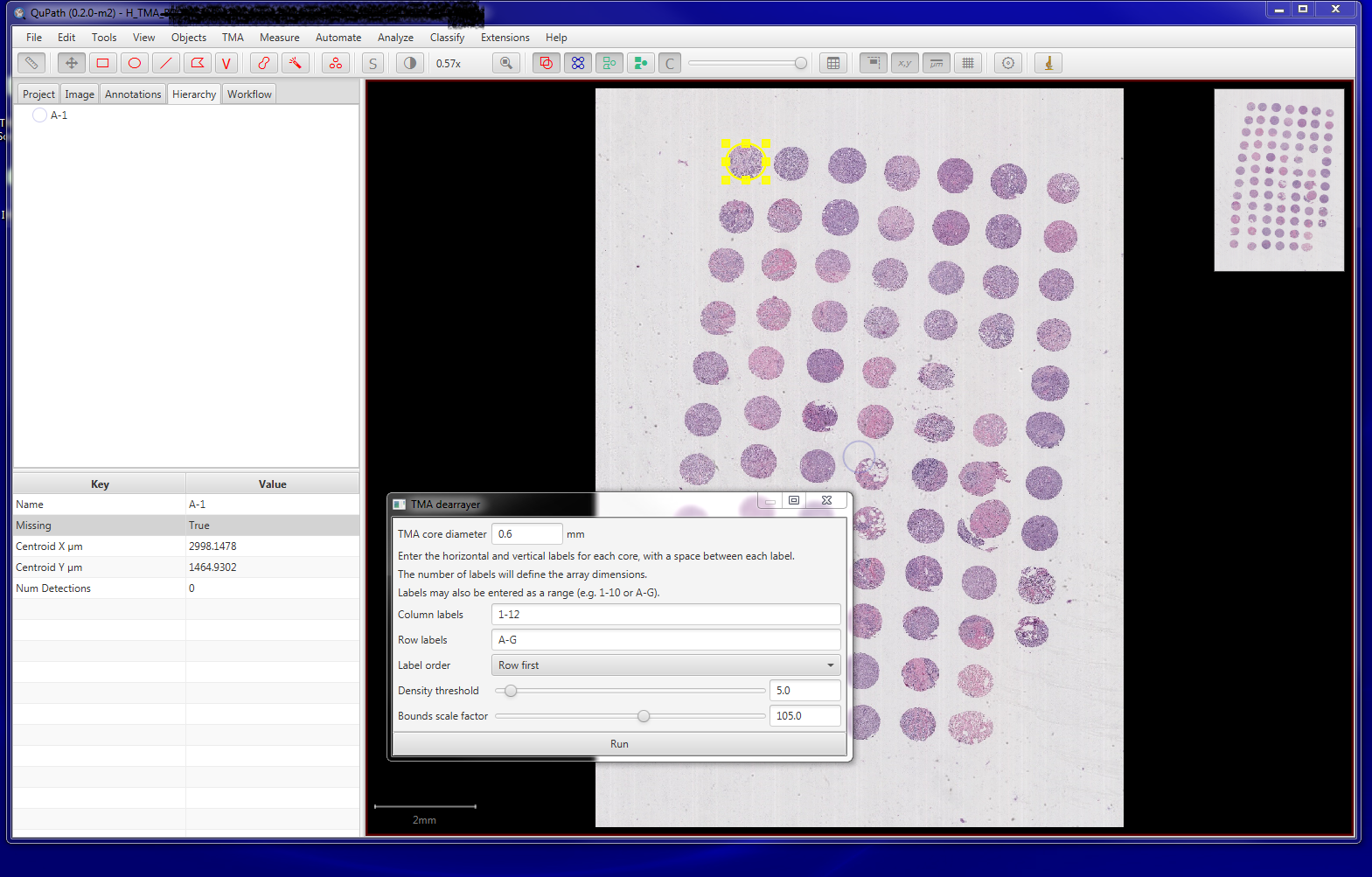 Tma Dearrayer Dosen T Work · Issue 329 · Qupath Qupath · Github