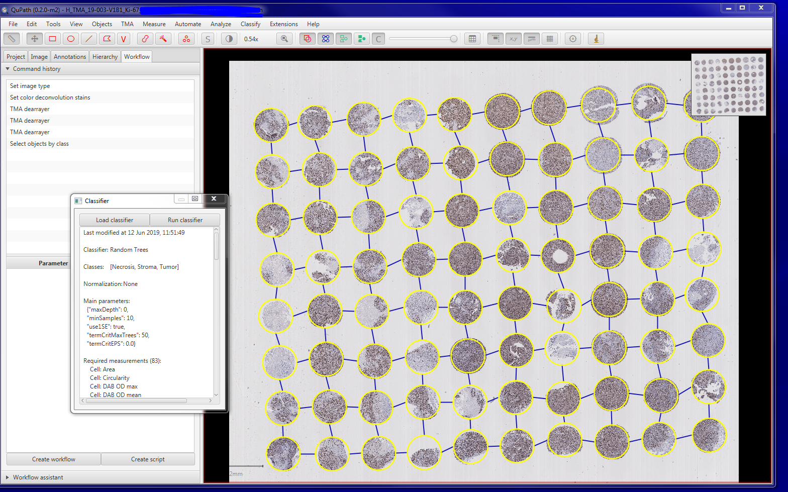 Saved Classifier Doesn T Work · Issue 331 · Qupath Qupath · Github