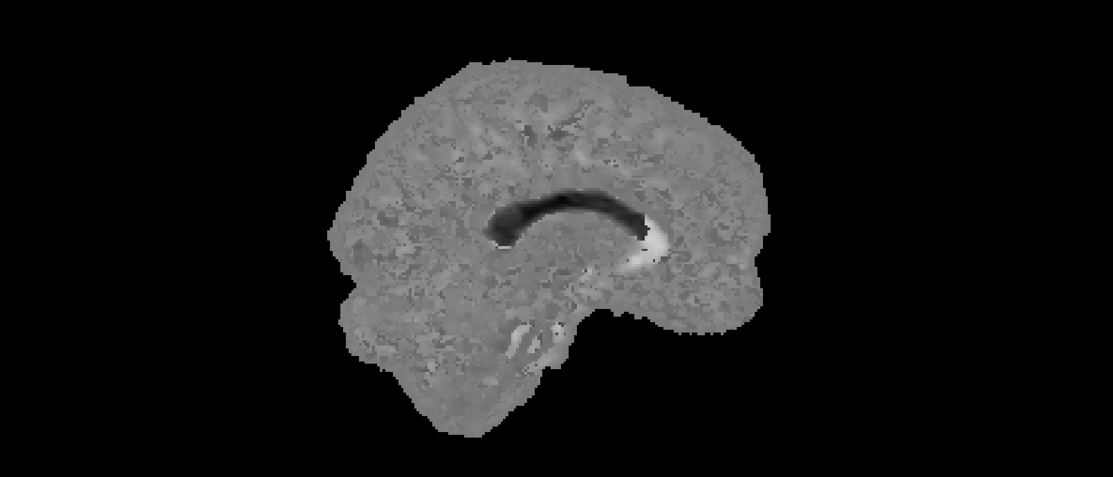 Problem with Tracking command · Issue #154 · MIC-DKFZ/TractSeg · GitHub