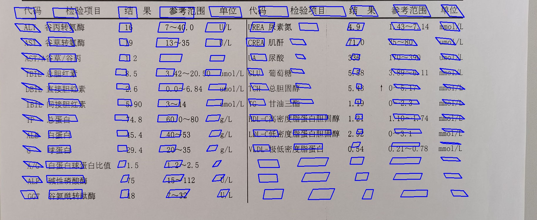 表格识别模型的slanetch模型微调结果不良的优化途径 · Issue 9481 · Paddlepaddlepaddleocr · Github 7486