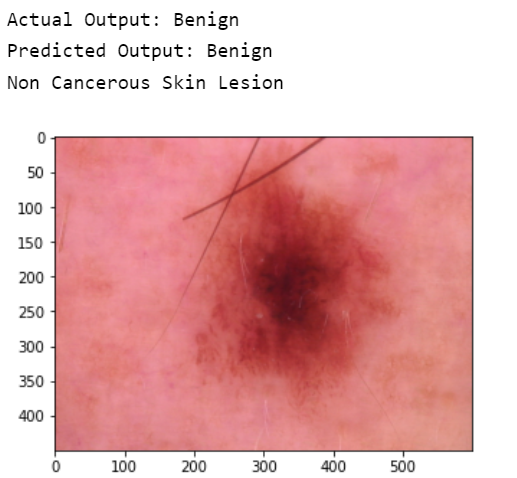 GitHub - vanshika1501/An-Explainable-Deep-Learning-Approach-for ...