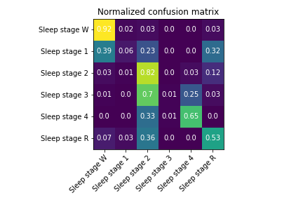 GitHub - puneethbanisetti/Big-Data-in-Healthcare---Sleep-Stage ...
