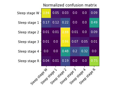 GitHub - puneethbanisetti/Big-Data-in-Healthcare---Sleep-Stage ...