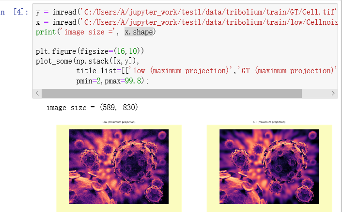 3D denoising · Issue #31 · CSBDeep/CSBDeep · GitHub