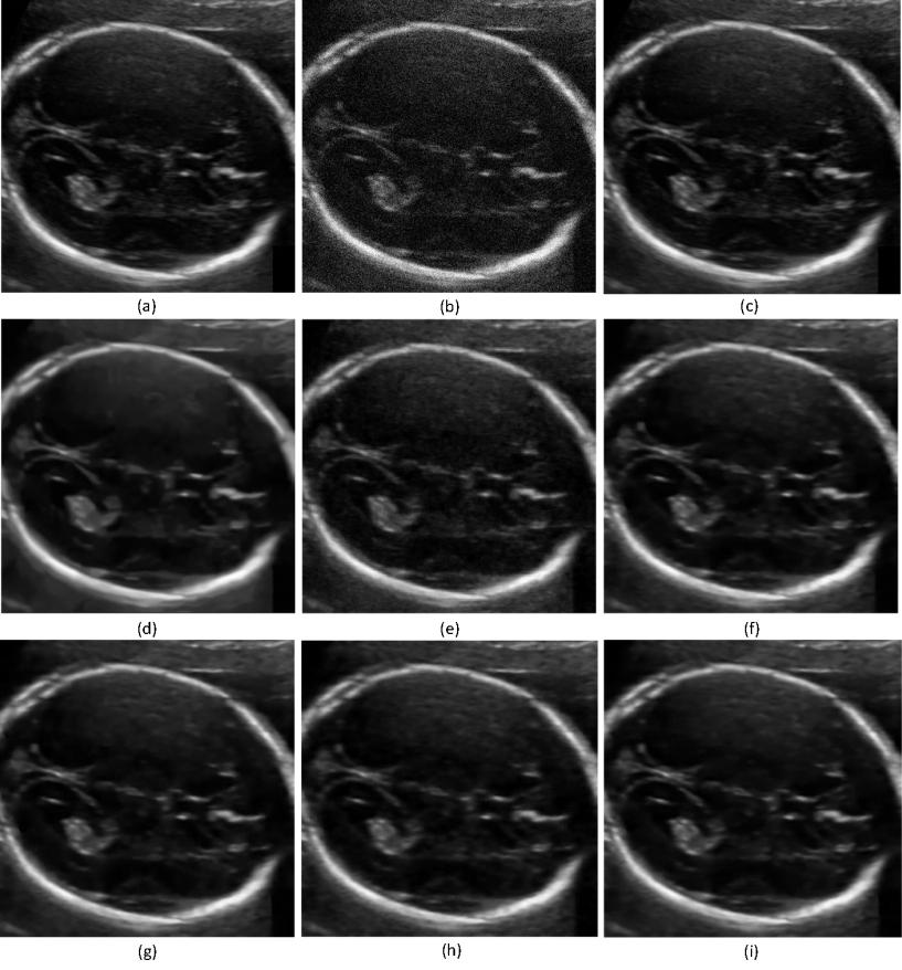 GitHub - liyanch/RED-SENet