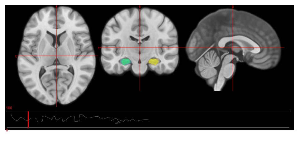 create 4D data volume scrolling canvas UI · Issue #65 · niivue/niivue · GitHub