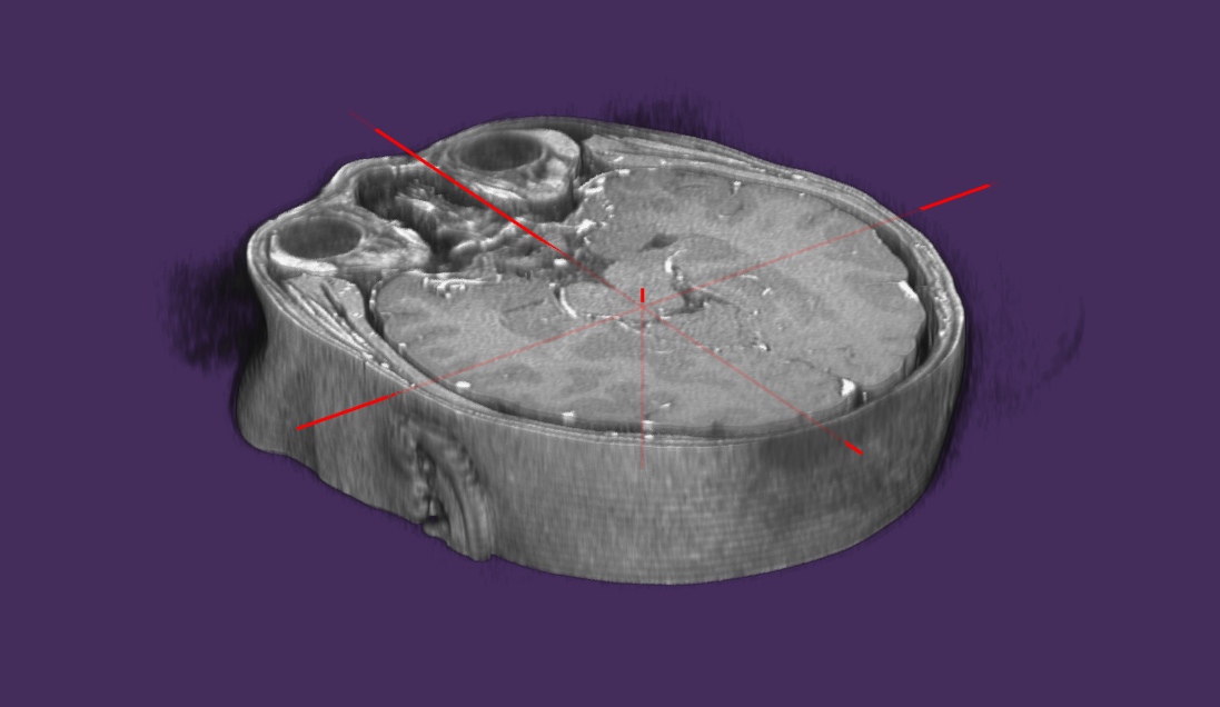 drawings do not appear in 3D render · Issue #339 · niivue/niivue · GitHub