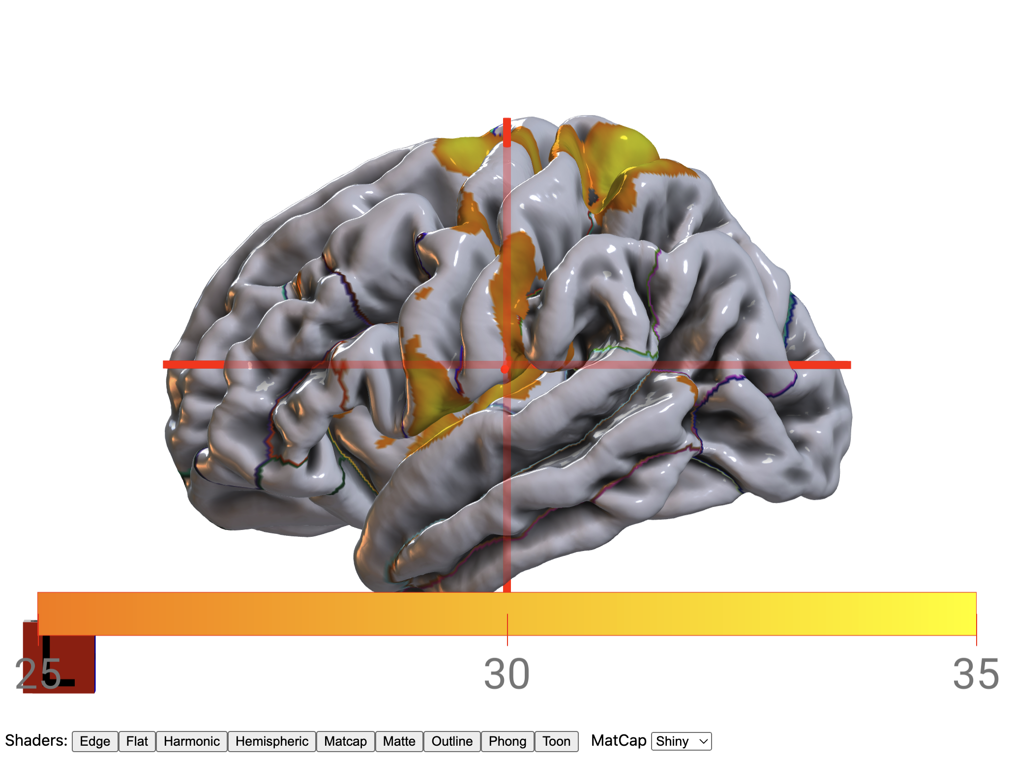 Support Viewing More File Formats In The Browser With Niivue · Issue 2760 · Openneuroorg 1136