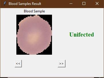 GitHub - zoravi1998/MalariaDetector