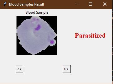 GitHub - zoravi1998/MalariaDetector