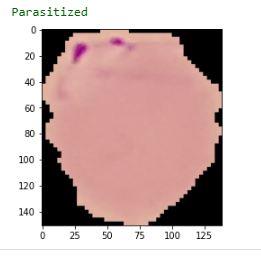 GitHub - zoravi1998/MalariaDetector