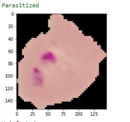 GitHub - zoravi1998/MalariaDetector