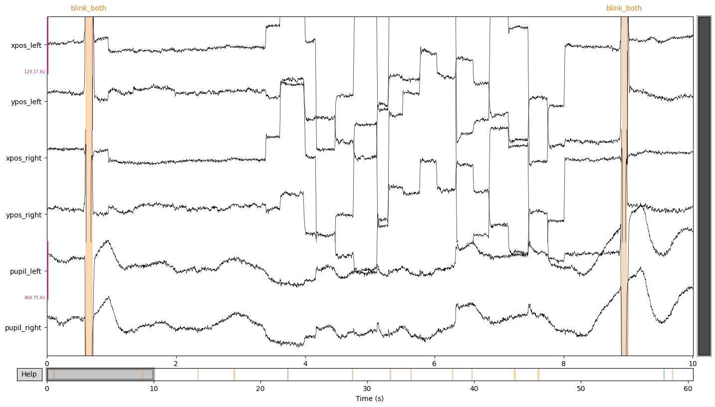 Feature Request: Interpolate blinks in eyegaze / pupil channels ...