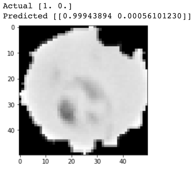 GitHub - komal-saini/malaria-classification-model