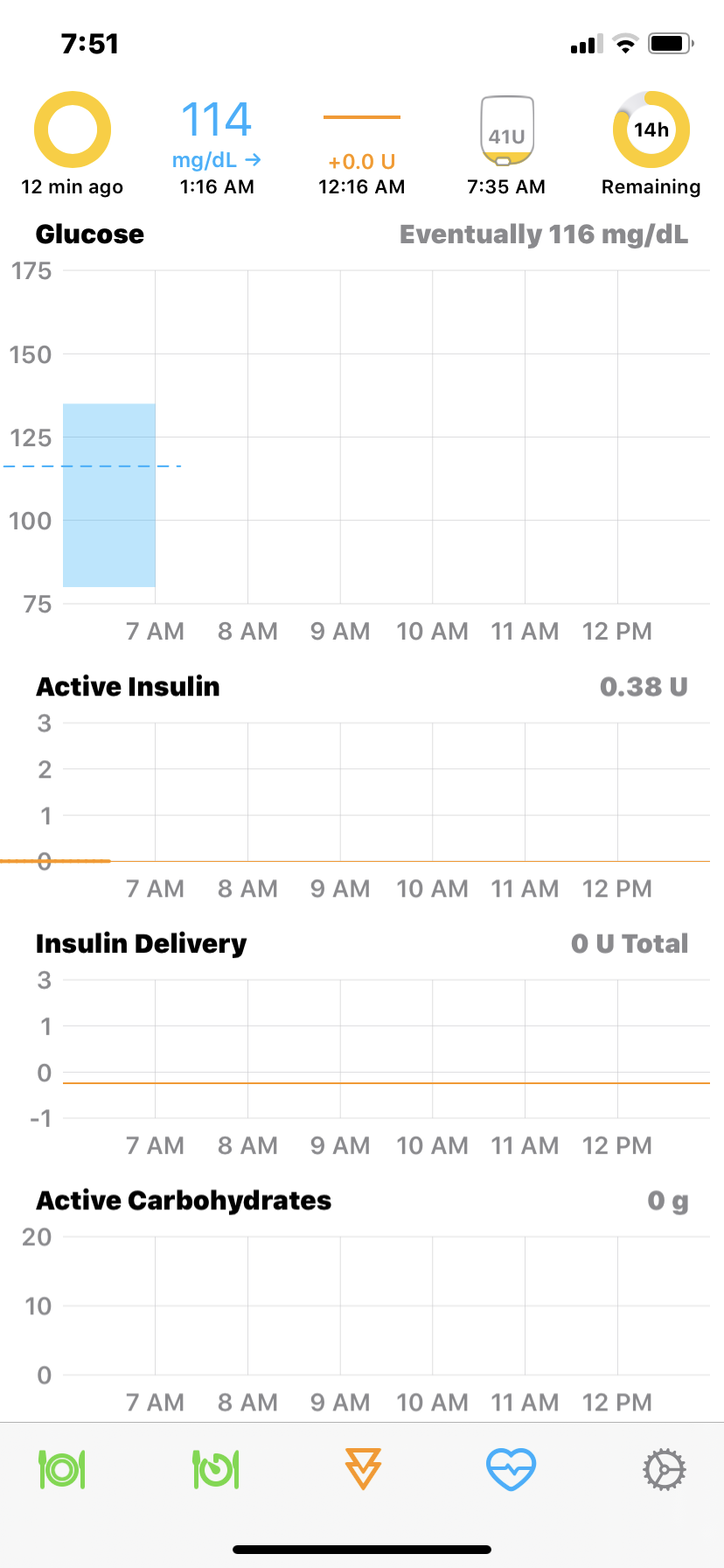 Loop not matching dexcom, not finding Riley link, and issues with lightning icon · Issue #1187 ...