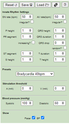 GitHub - vie74050/ecgpacerapp: Single page webapp to simulate ECG and pacemaker functions, used ...