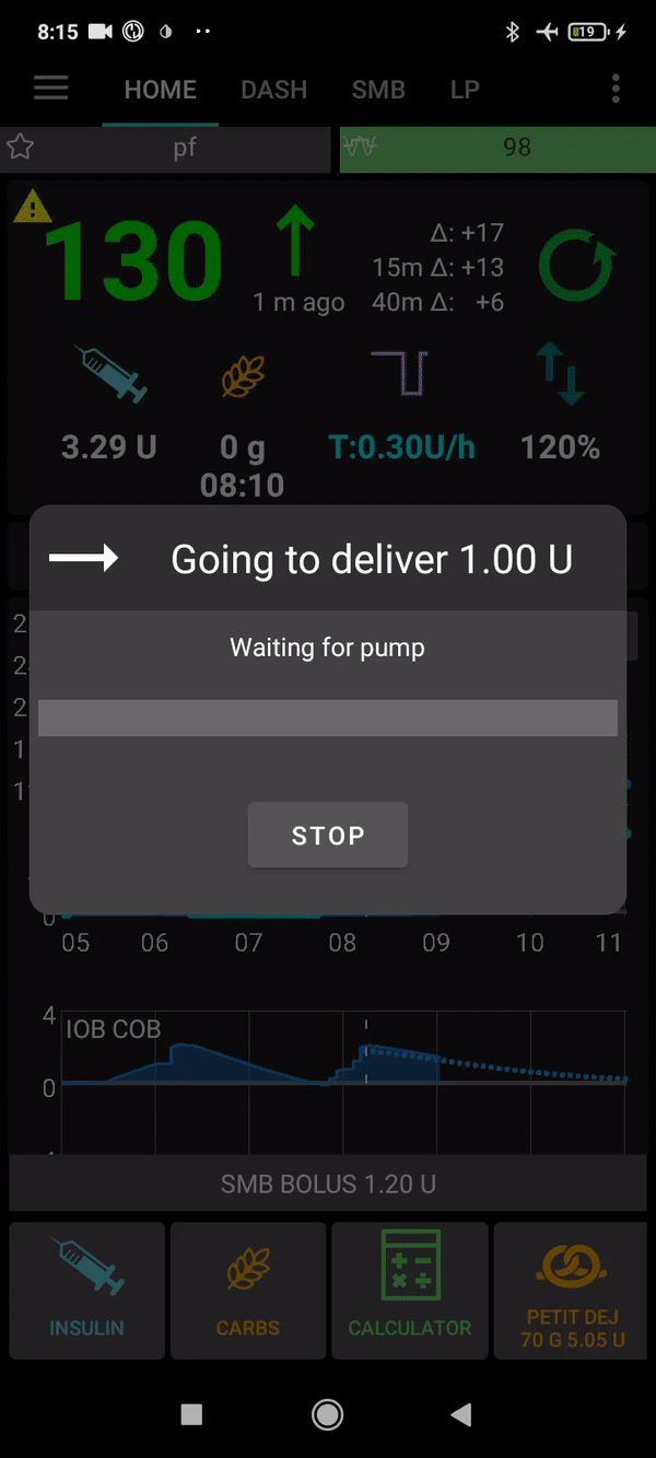 Bolus cannot be cancelled · Issue #1834 · nightscout/AndroidAPS · GitHub