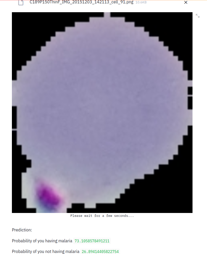 GitHub - parikshitkumar1/Malaria_Detection_App: Classifies cell images into Parasitized ...