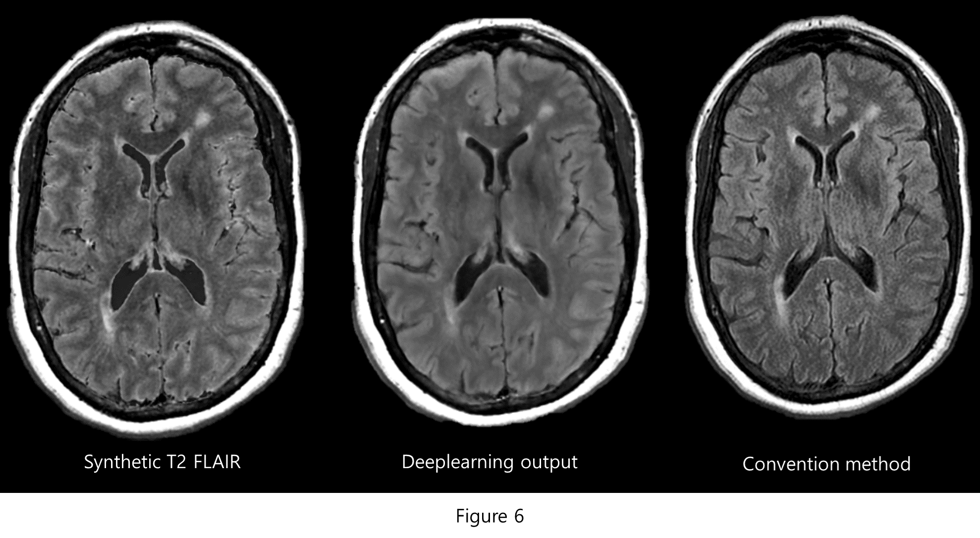 GitHub - Sanghyeoklab/Synthetic-MRI-correction