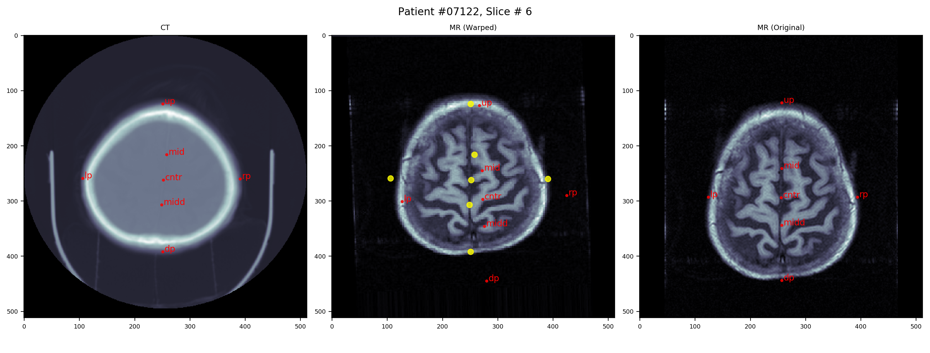 There are some problems with the Transformation Matrices issued by the Voxelmorph! · Issue #266 ...