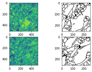 GitHub - christopher-2000/Neuronal-Structure-Segmentation-with-UNET