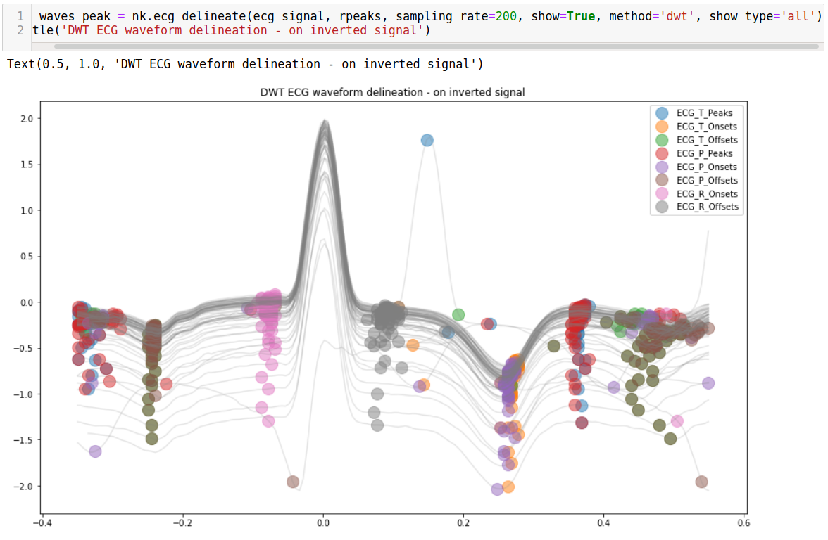 Do ECG analysis functions require R peaks to be pointing upwards ...