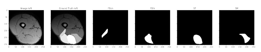 GitHub - zeyneb-chiha/Deep-Learning-based-Thigh-limb-Muscle-Segmentation-for-Reproducible-Volume ...