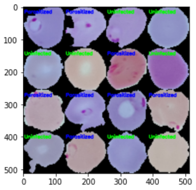 GitHub - behnoudshafizadeh/MALARIA-DETECTION-CNN: using CNN for ...