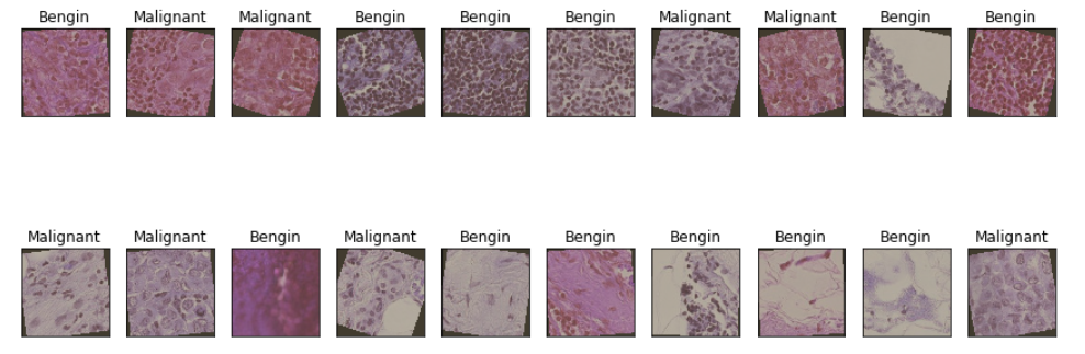 GitHub - Zeel2864/Histopathological-cancer-Detection
