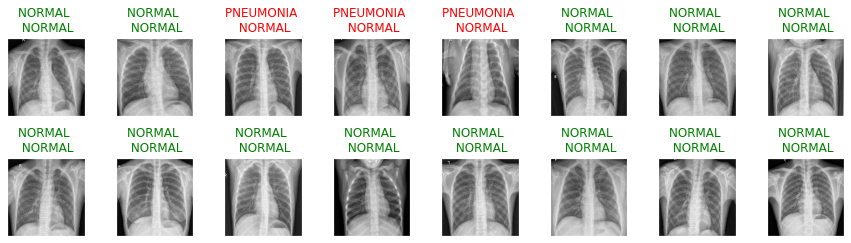 GitHub - Kittycatangel/X_ray_pneumonia_Project