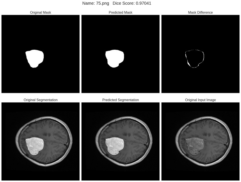 GitHub - Kittycatangel/Brain_Tumor_Project