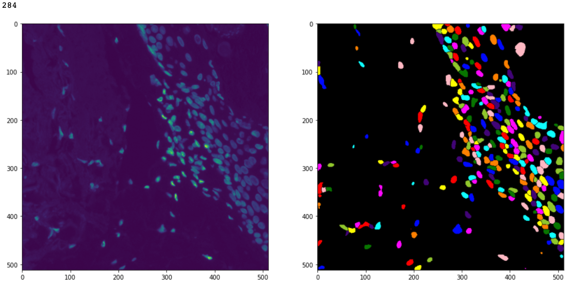 Assist user to choose the proper parameter **micron per pixel** · Issue #471 · vanvalenlab ...