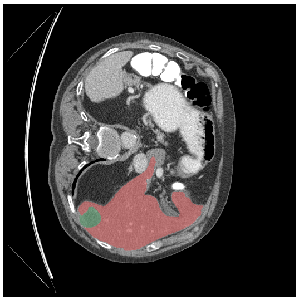 GitHub - DominikKwiatkowski/tomography