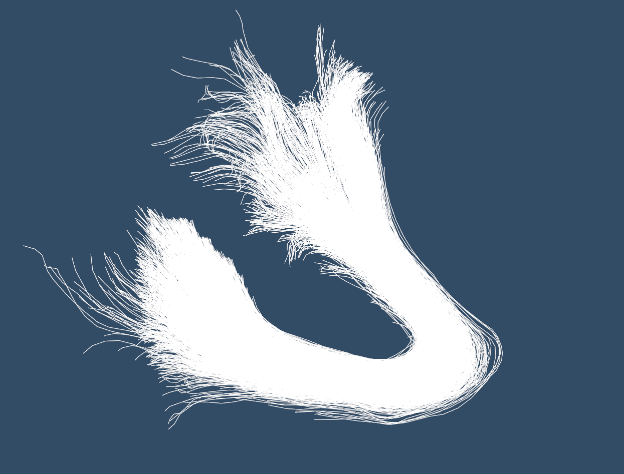 Simpleitk Cannot Read Vtk Polydata · Issue 1095 · Simpleitk Simpleitk · Github