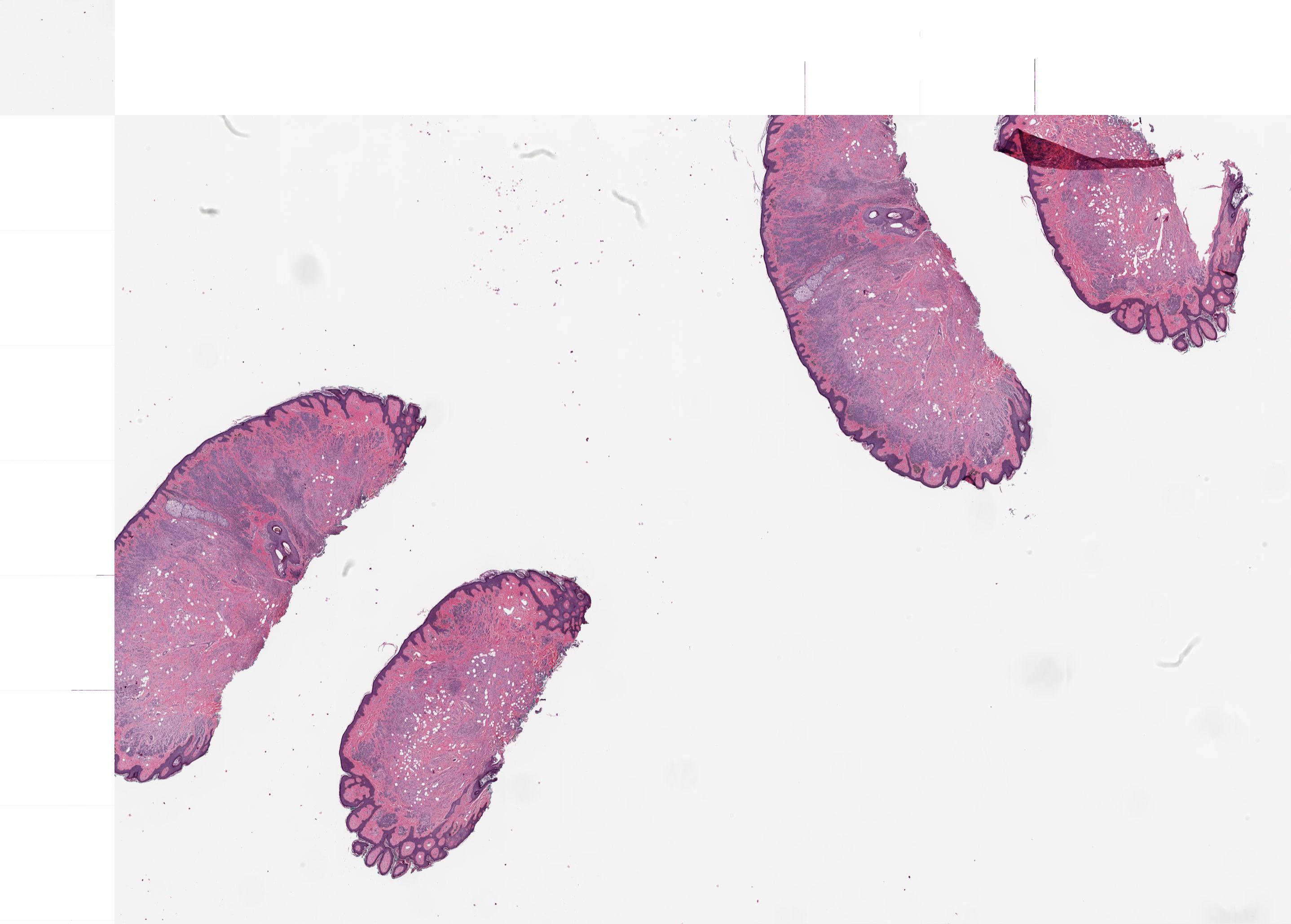 Svs Image Convert To · Issue 1401 · Libvipslibvips · Github