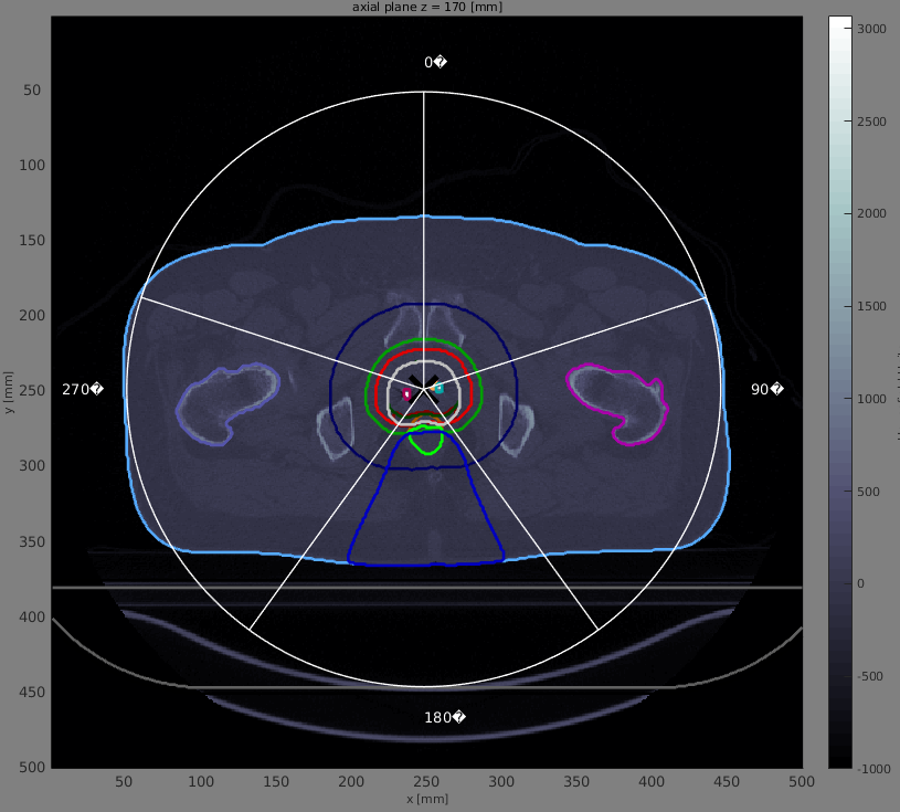 Question about EUD objectives/constraints · Issue #415 · e0404/matRad ...
