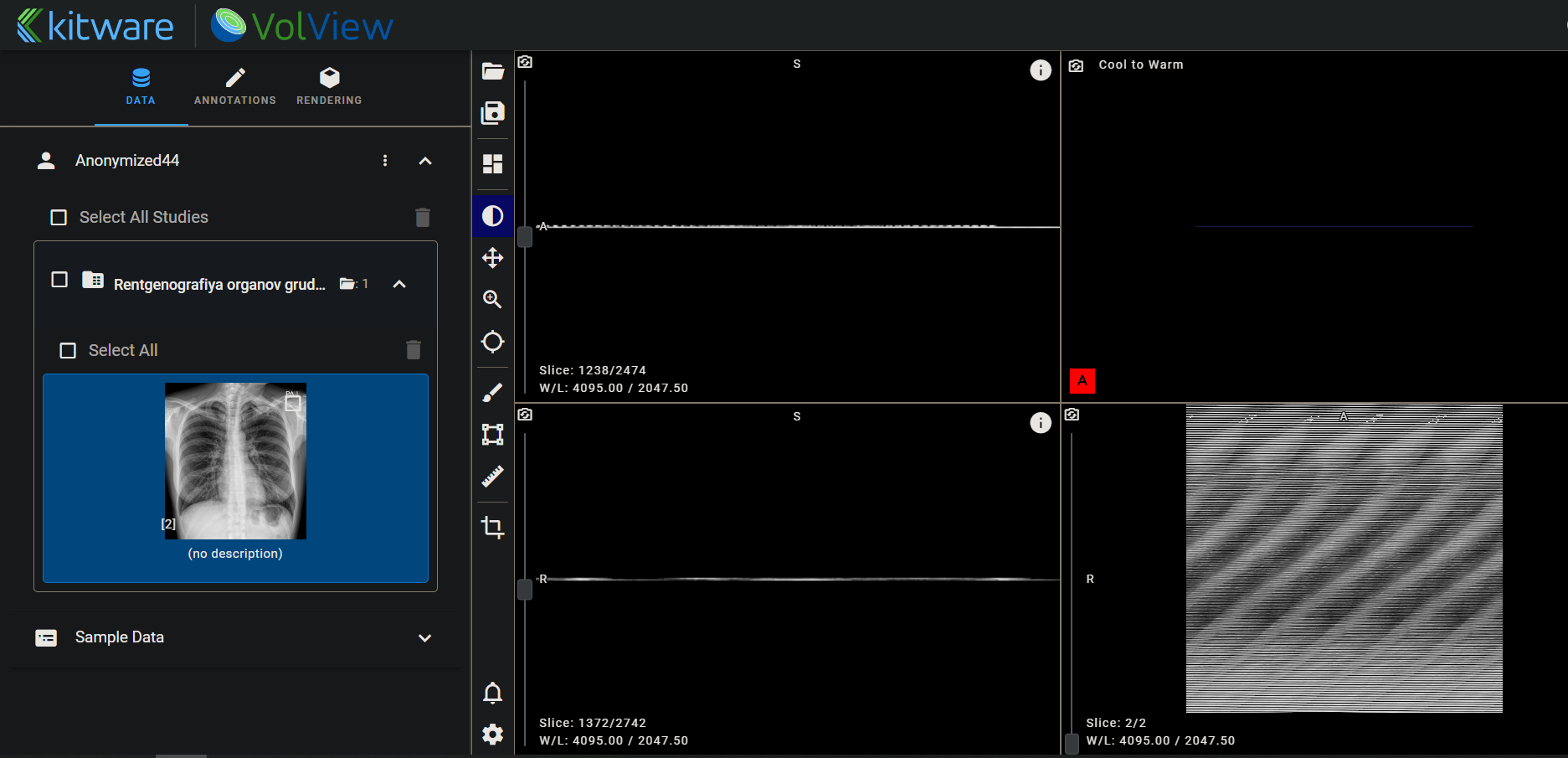VolView doesn't correctly load multiple DX modality images · Issue #330 · Kitware/VolView · GitHub