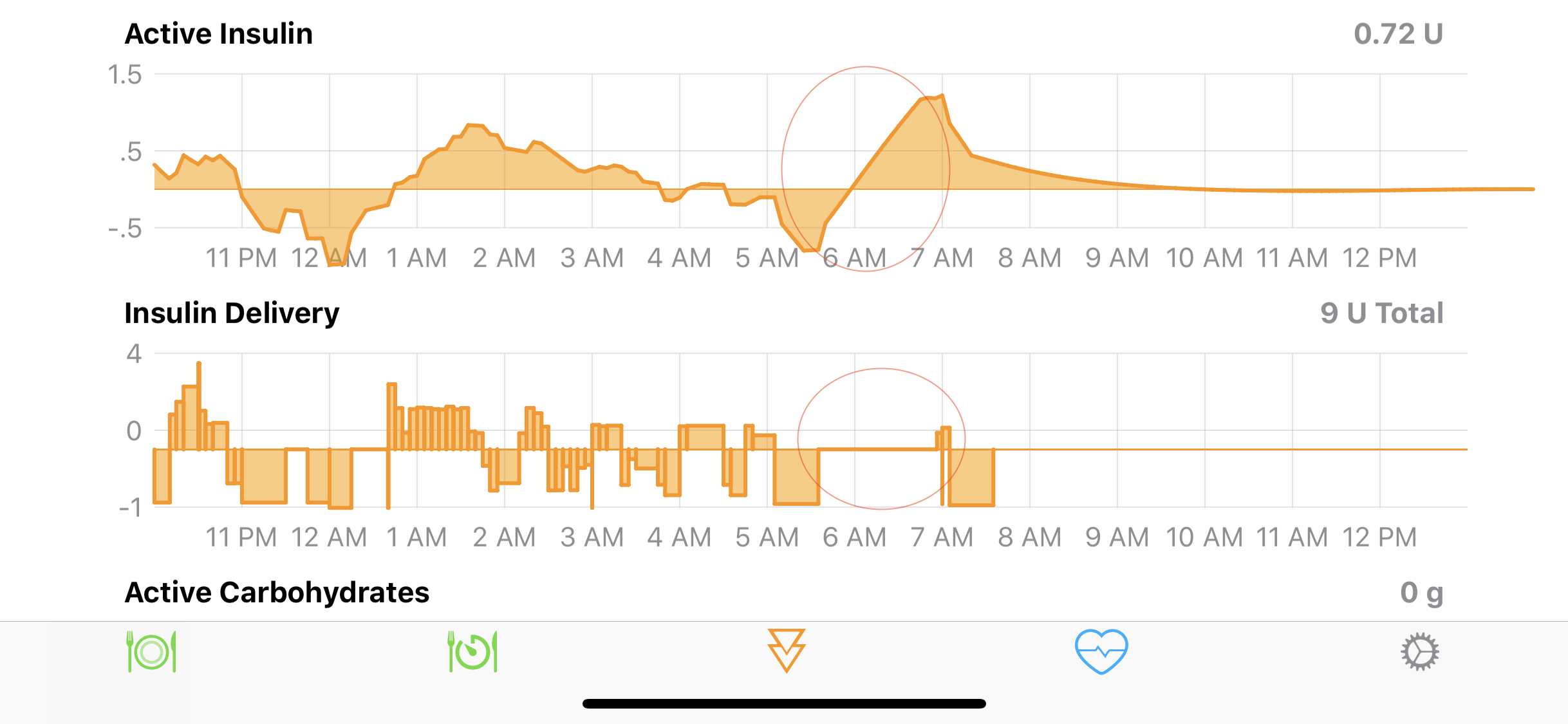 IOB does not match insulin delivery · Issue #1035 · LoopKit/Loop · GitHub