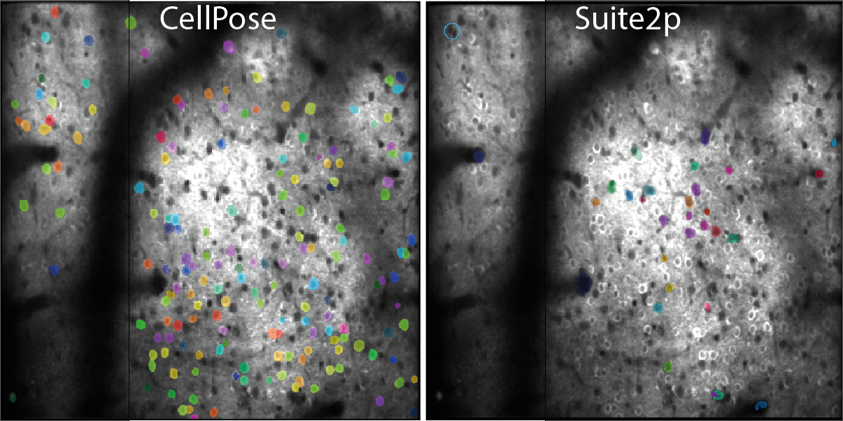 Bad performance using cellpose in suite2p · Issue #620 · MouseLand/suite2p · GitHub