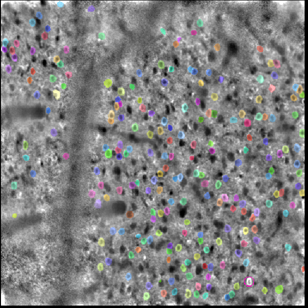 Bad performance using cellpose in suite2p · Issue #620 · MouseLand/suite2p · GitHub